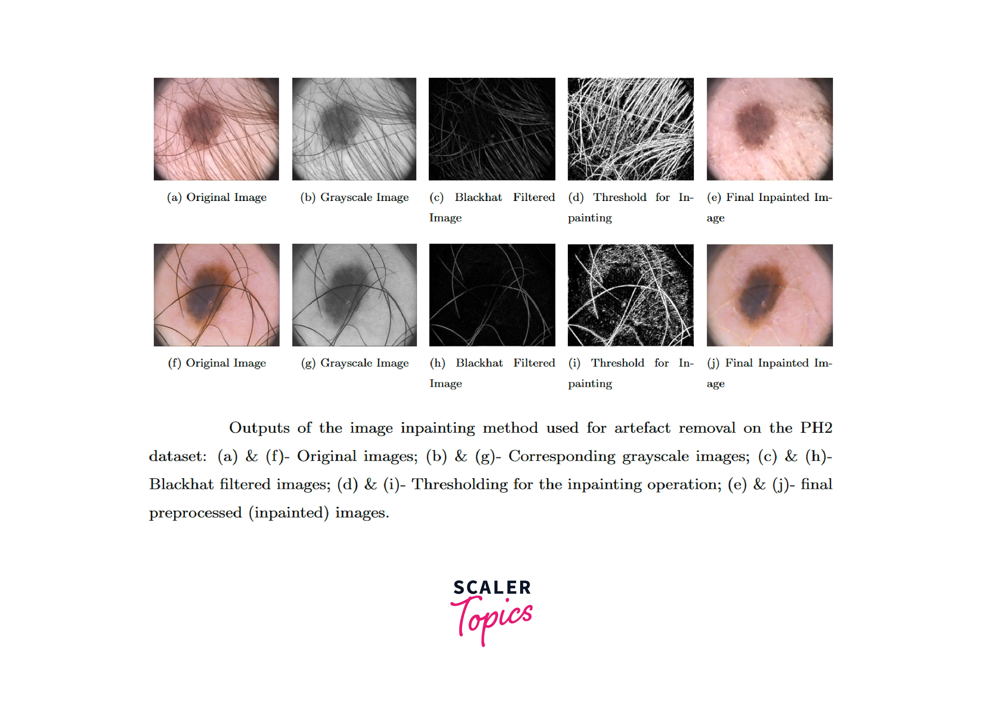 Fundamental Steps In Digital Image Processing - Scaler Topics
